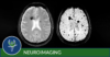 Neuroimaging - Capitol Imaging Services
