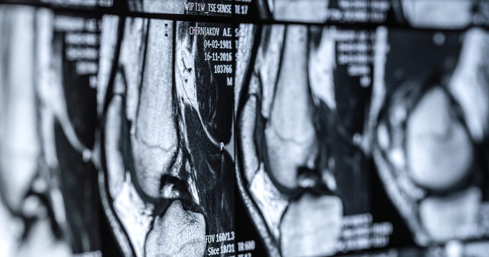 What is the function of an imaging test? - Capitol Imaging Services