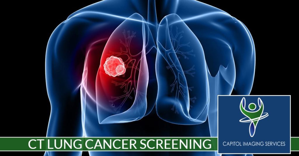 Lung Cancer Screening - Capitol Imaging Services