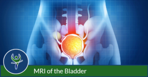 MRI of the Bladder - Capitol Imaging Services